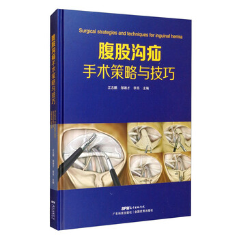 腹股沟疝手术策略与技巧