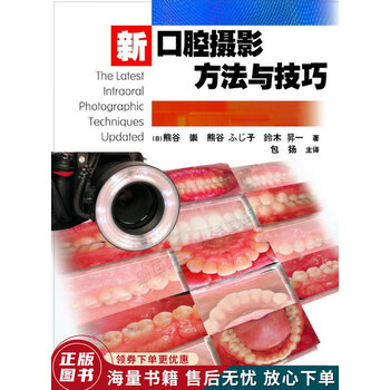 新口腔摄影方法与技巧