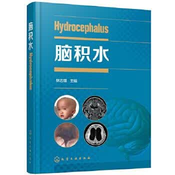 [上新包邮] 脑积水 林志雄 主编 化学工业出版社