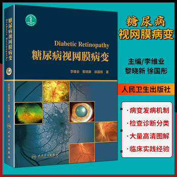 糖尿病视网膜病变 人民卫生出版社