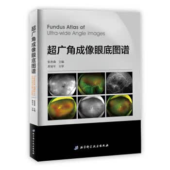 超广角成像眼底图谱