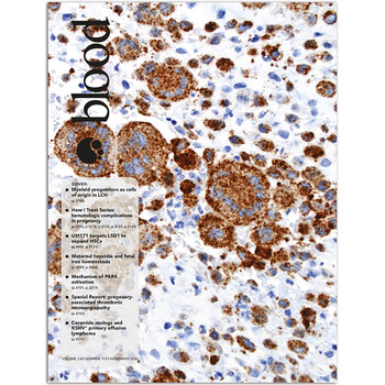 【单期可选】Blood Vol.136.9 血液学基础实验和临床研究 2020年11月5日刊 2020年11月5日刊