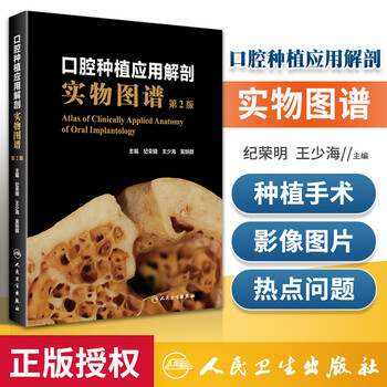 正版 口腔种植应用解剖实物图谱（第2版）人民卫生出版社纪荣明,王少海,吴轶群