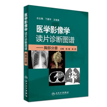 医学影像学读片诊断图谱：胸部分册 医学影像学图谱：胸部分册