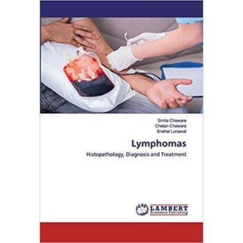 Lymphomas
