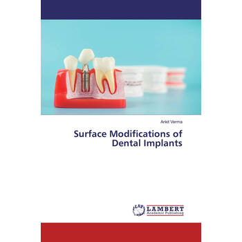Surface Modifications of Dental Implants