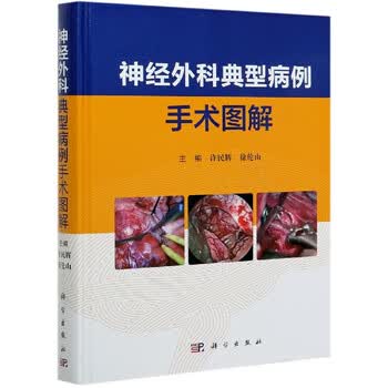 神经外科典型病例手术图解(精)