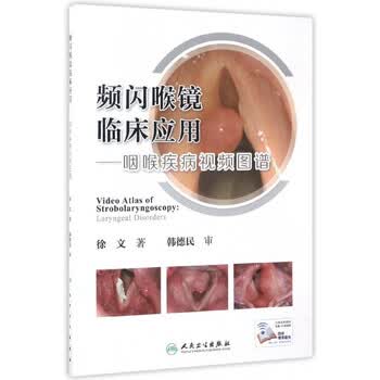 频闪喉镜临床应用--咽喉疾病视频图谱