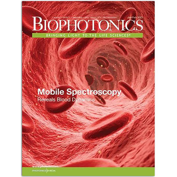 【单期可选】Biophotonics 美国生物光子学杂志 2020/21年月刊 2021年1/2月合刊