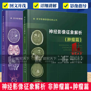 正版 神经影像征象解析 非肿瘤篇+肿瘤篇 医学影像联盟JD丛书 王宇军等主编 肿瘤性与非肿瘤性病变 书籍套装k