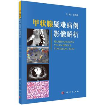 甲状腺疑难病例影像解析