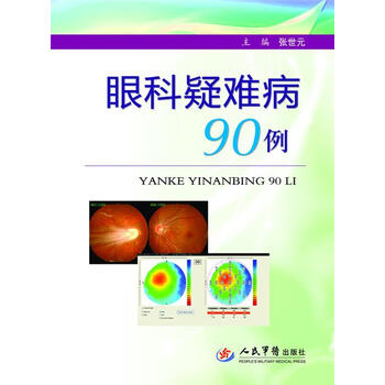 眼科疑难病90例 张世元 著【正版书】