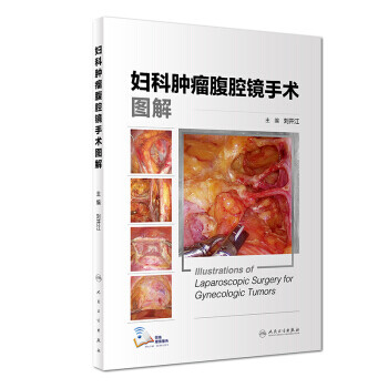 [正版图书]妇科肿瘤腹腔镜手术图解 刘开江 人民卫生出版社 9787117271066-1