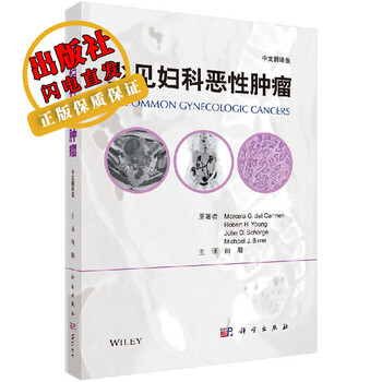少见妇科恶性肿瘤 向阳译