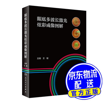 眼底多波长激光炫彩成像图解
