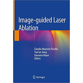 Image-Guided Laser Ablation