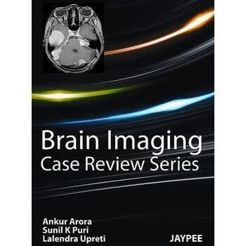 Brain Imaging