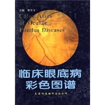 临床眼底病彩色图谱