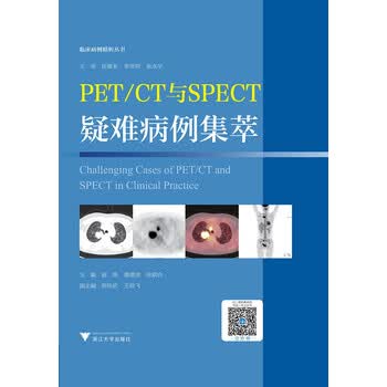 PETCT与SPECT疑难病例集萃 赵 葵 潘建虎 张联合 浙江大学出版社 978730817045