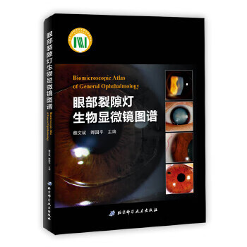 眼部裂隙灯生物显微镜图谱【正版图书】