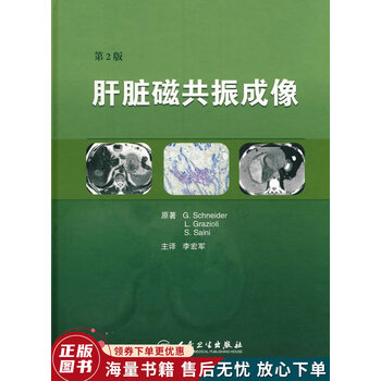 肝脏磁共振成像