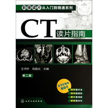 CT读片指南(第2版)/影像读片从入门到精通系列