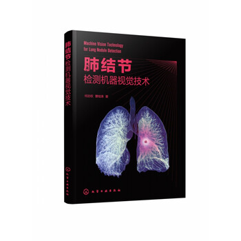 肺结节检测机器视觉技术