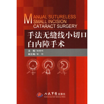 手法无缝线小切口白内障手术
