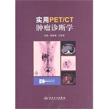 实用PET CT肿瘤诊断学【正版图书】