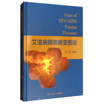 眼底病图谱【正版图书】