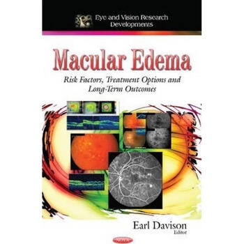 Macular Edema: Risk Factors, Treatment Optio...