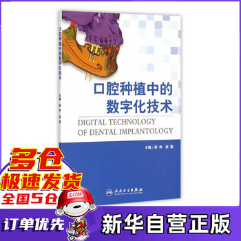 口腔种植中的数字化技术