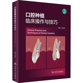 口腔种植临床操作与技巧 图书