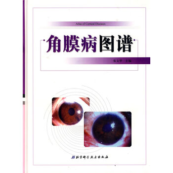 角膜病图谱 张文华