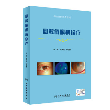 图解角膜病诊疗【正版图书】