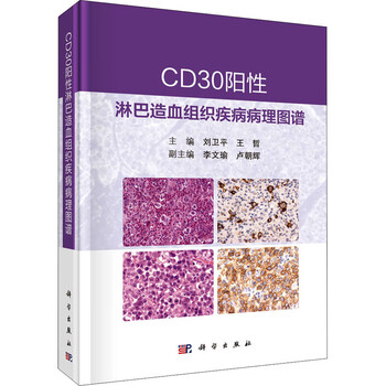 CD30阳性淋巴造血组织疾病病理图谱 刘卫平,王哲 编 书籍