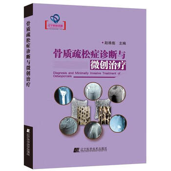骨质疏松症诊断与微创治疗 赵维彪 辽宁科学技术出版社