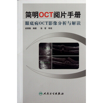 简明OCT阅片手册(眼底病OCT影像分析与解读)