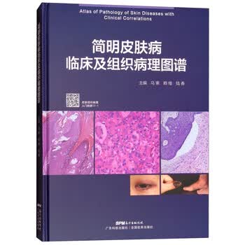 正版 （精装）简明皮肤病临床及组织病理图谱9787535970015