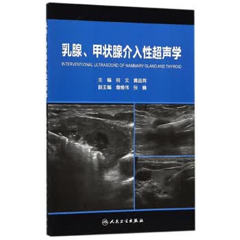 乳腺甲状腺介入性超声学
