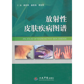 放射性皮肤疾病图谱