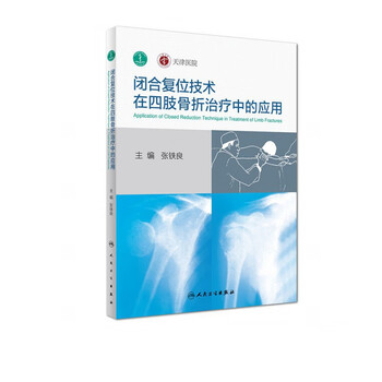 闭合复位技术在四肢骨折治疗中的应用(精)