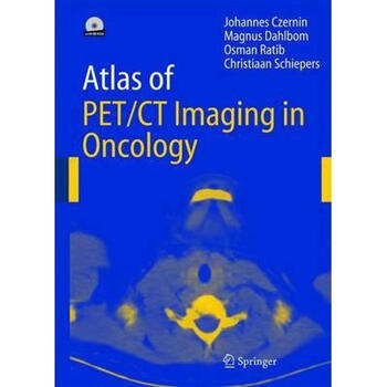 Atlas of Pet/CT Imaging in Oncology
