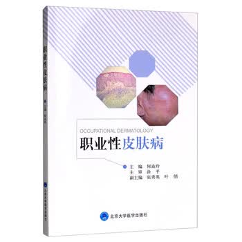 职业性皮肤病