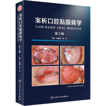 案析口腔黏膜病学 第2版