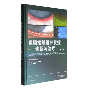 角膜接触镜并发症诊断与治疗