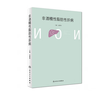 非酒精性脂肪性肝病