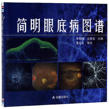 正版 简明眼底病图9787508292489