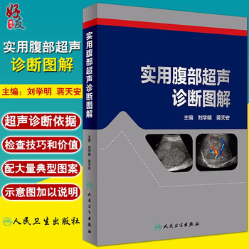 正版 实用腹部超声诊断手册图解 刘学明 蒋天安主编 人民卫生出版社 腹部疾病 超声波诊断图解 医学超