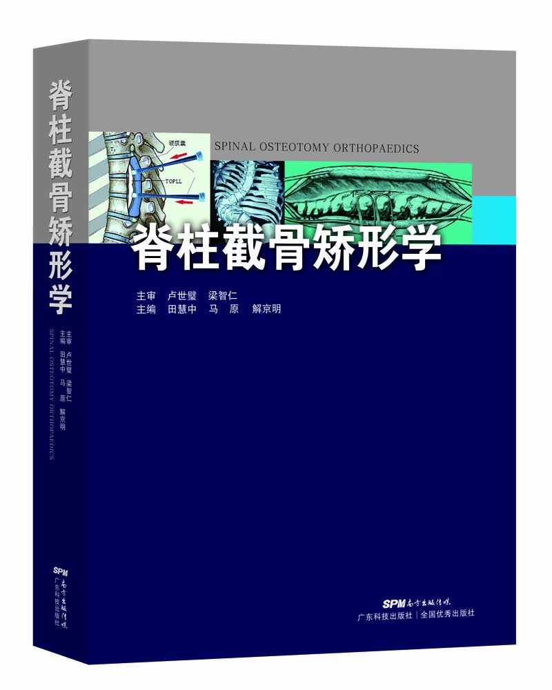 脊柱截骨矫形学